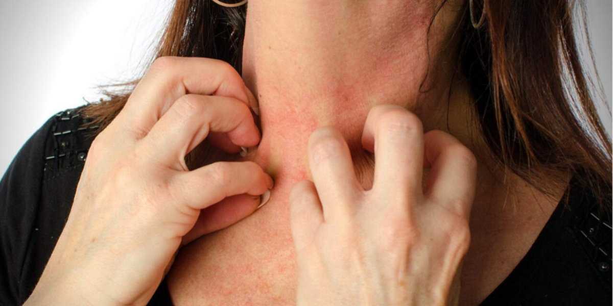 Allergic to Metals? Be Cautious Around These Items | New York Allergy ...